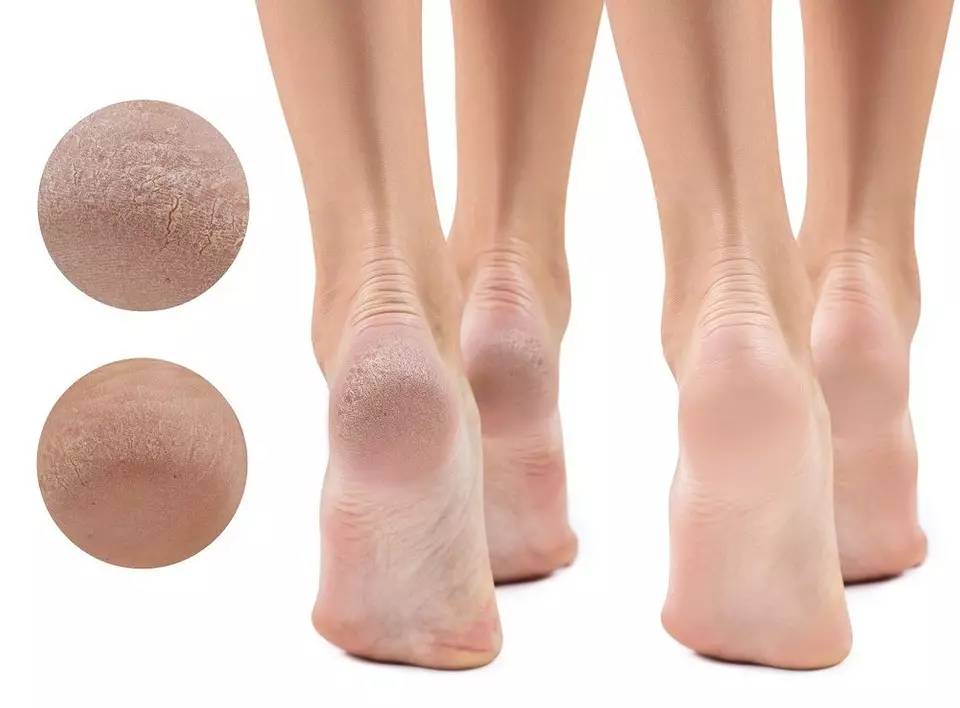 Et si vous conduisez la peau sur les jambes? 10 conseils